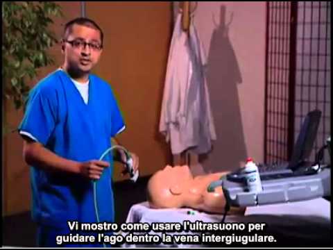Video procedurale: Giugulare interna e inserimento dell'ago per l ...