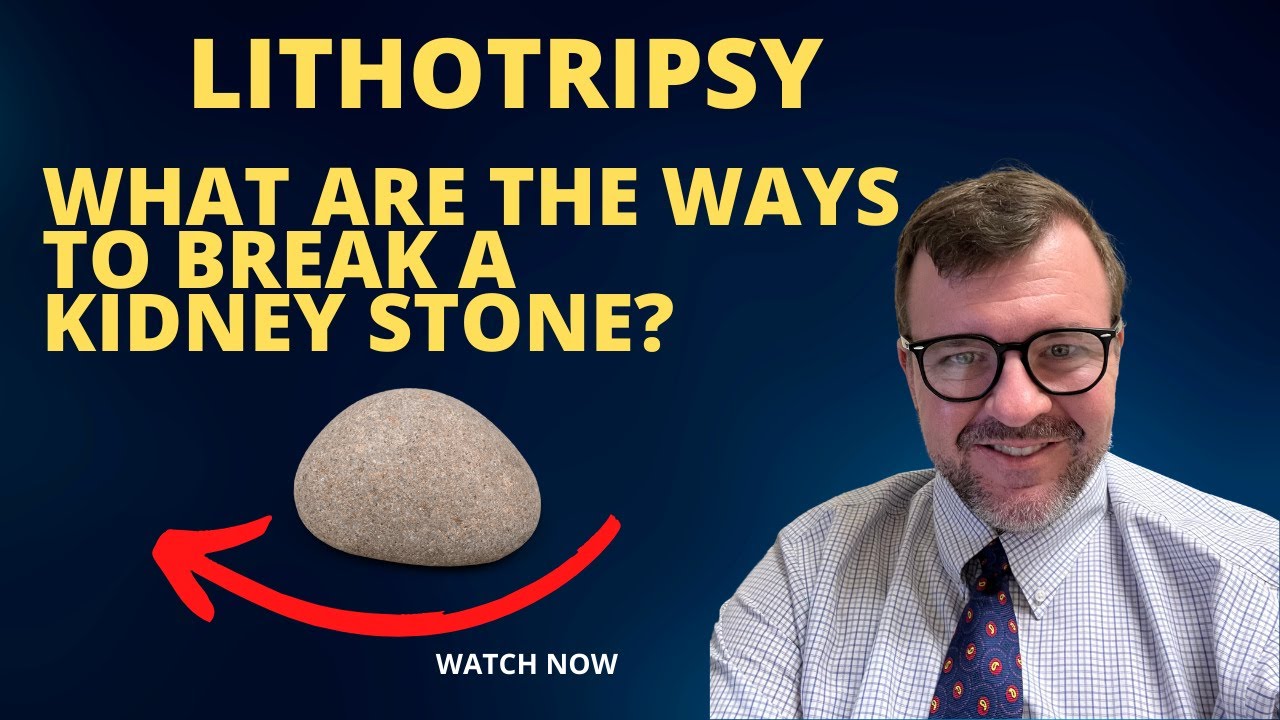 What are the types of lithotripsy: How to Break a Stone- Dr Kent DeLay ...