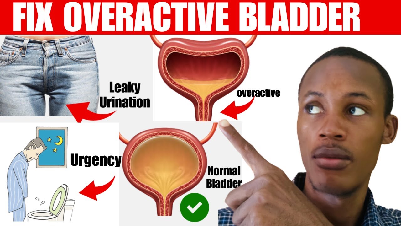 Easy Steps To Fix Urinary Frequency Overactive Bladder Youtube