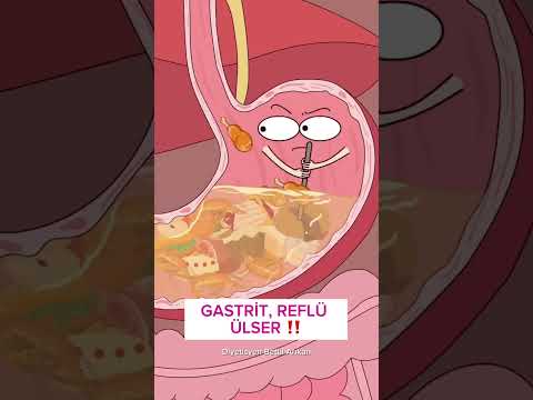 Gastrit mi, Ülser mi? | Mide Yanması Neden Olur?