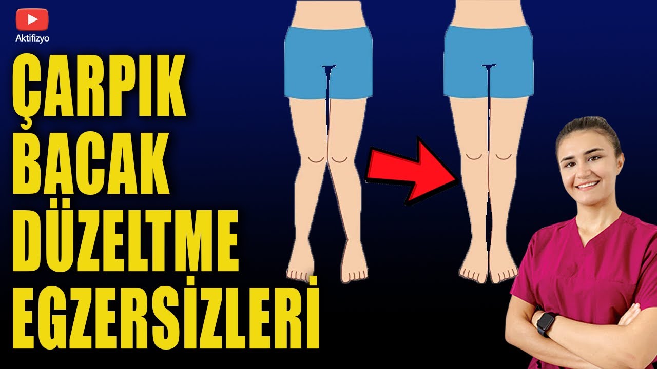 ÇARPIK BACAK EGZERSİZLERİ #aktifizyo #dizağrısı #fiziktedavi - YouTube