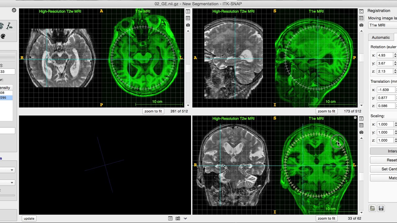very short demo of registration in ITK-SNAP 3.6 - YouTube