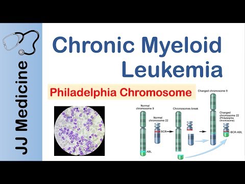 Chronic Myeloid Leukemia (CML) | Pathogenesis, Symptoms and Treatment