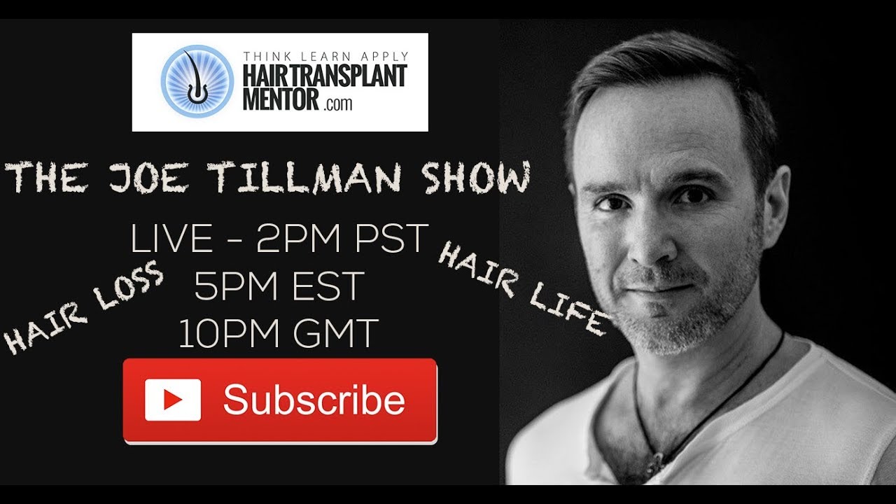 Live Stream! The Joe Tillman Show! Hair Loss, Hair Life, Hair Stuff ...
