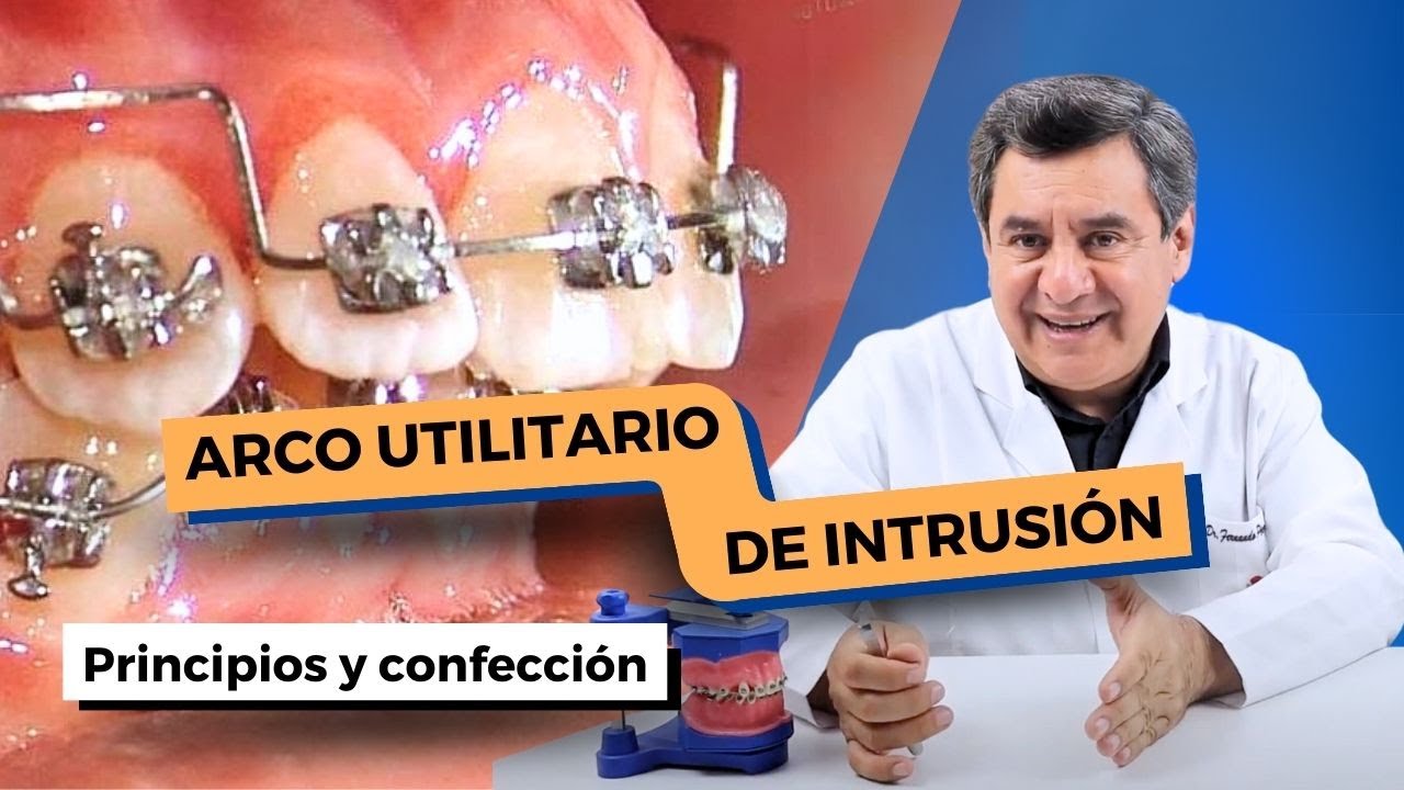 Como crear un arco de intrusión en ortodoncia para lograr una sonrisa ...