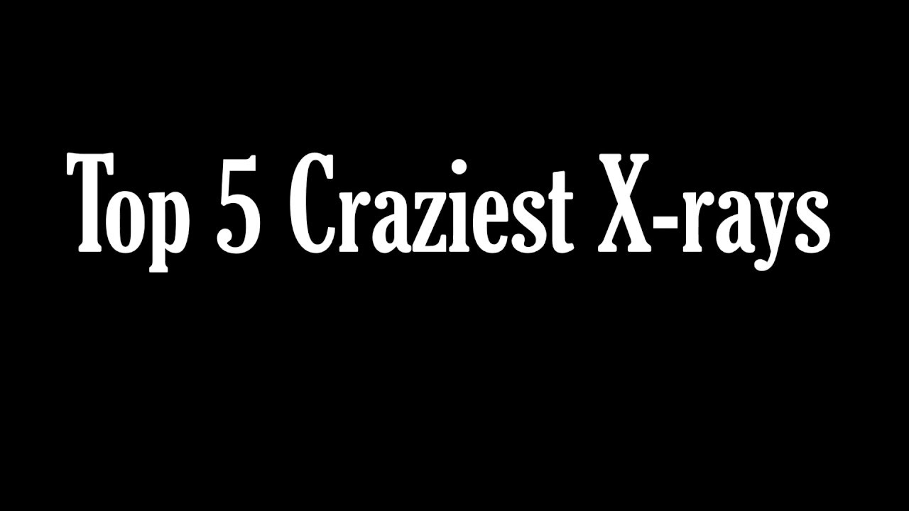 5 Craziest X-Rays You Won't Believe Are Real - YouTube