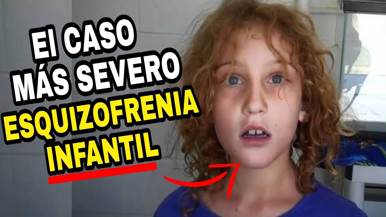 El CASO De ESQUIZOFR3N14 INFANTIL Más SEVERO 😱 (JANI SCHOFIELD) - YouTube