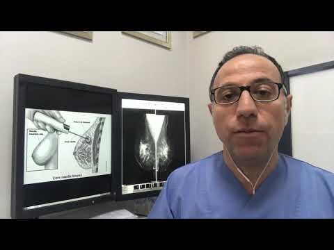 MEME BİYOPSİSİ NASIL YAPILIR?