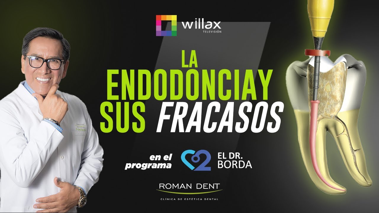 LA ENDODONCIA Y FRACASOS, ES POSIBLE HABLAR DE UN FRACASO ENDODONTICO ...
