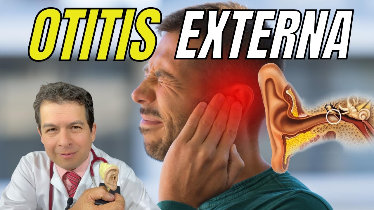 Oído de Nadador: ¿Qué es la Otitis Externa? tratamiento natural - YouTube