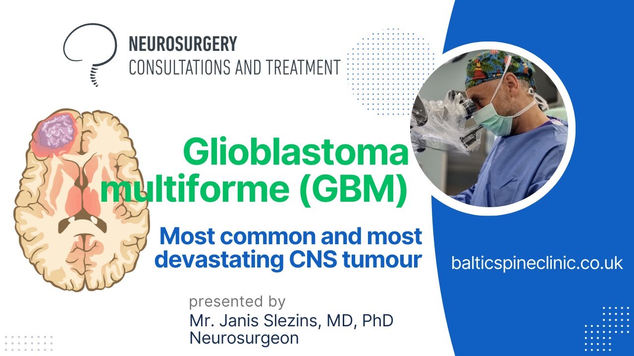 Glioblastoma multiforme (GBM) - most deadly brain tumour! - YouTube