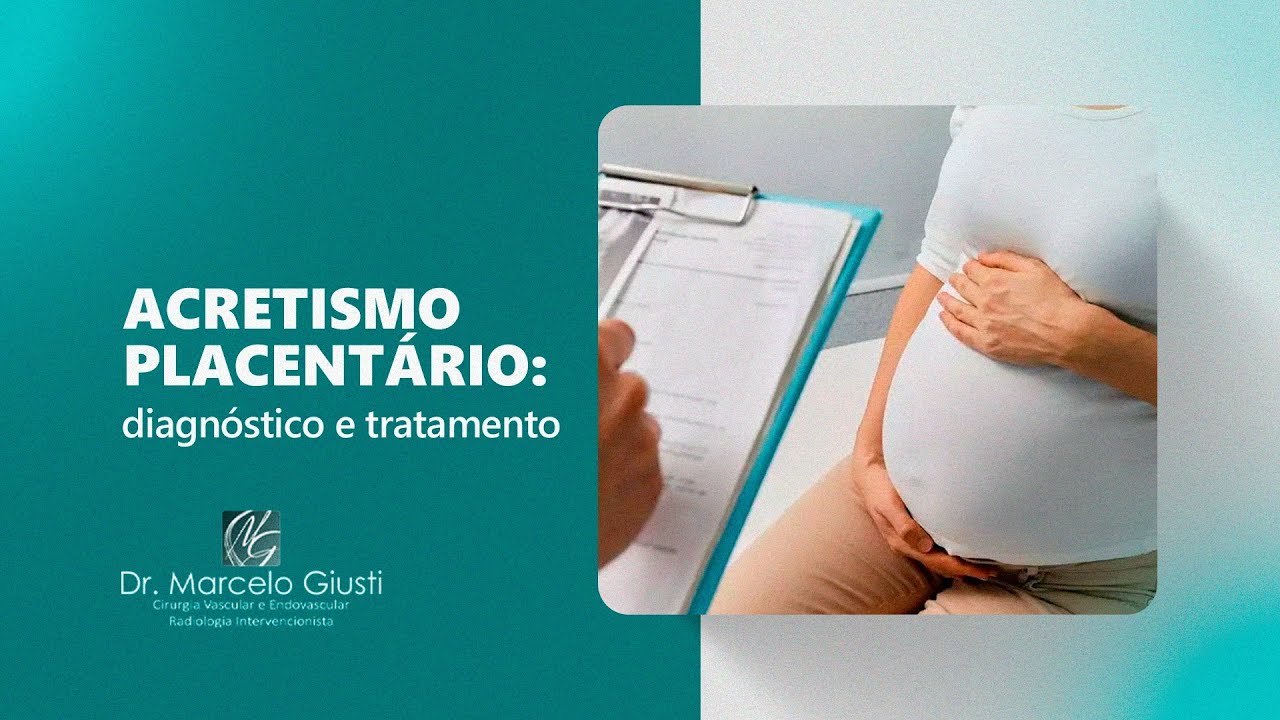 Acretismo Placentário: diagnóstico e tratamento! - YouTube
