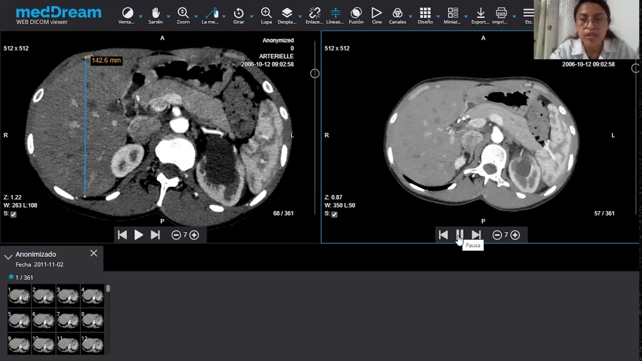 Video de formato DICOM - YouTube
