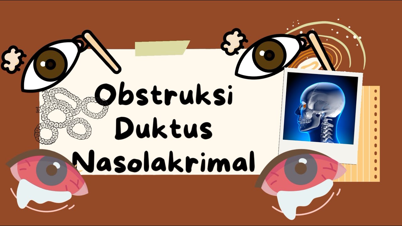 Obstruksi Duktus Nasolakrimalis - YouTube