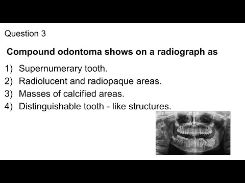 INBDE Sample Questions - Oral Pathology - YouTube