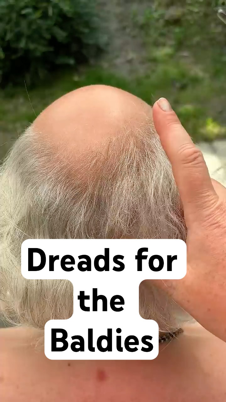 Who said bald guys can’t pull off dreads? - YouTube