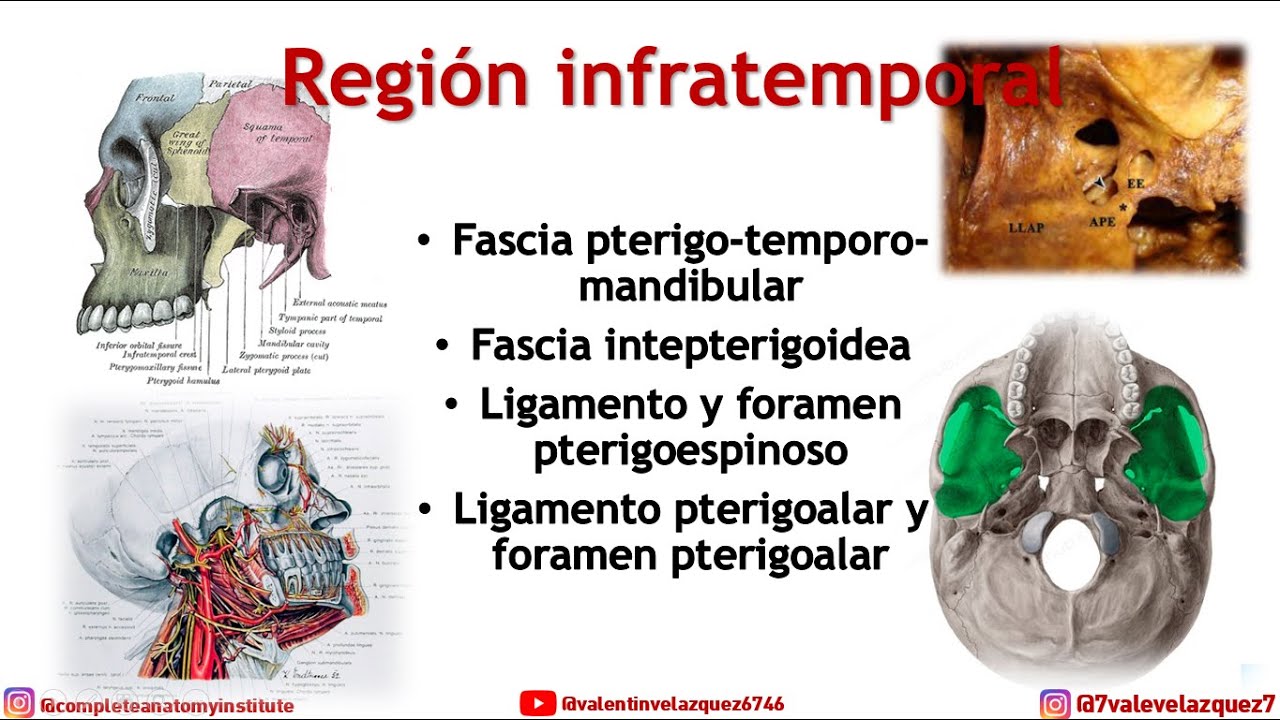 FOSA INFRATEMPORAL (FASCIAS) (Pt. 2) - Poro crotafítico buccinatorio de ...