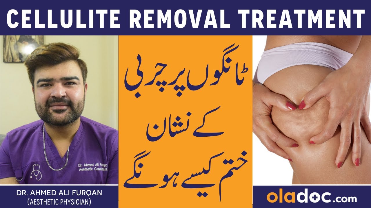 How To Get Rid Of Cellulite Naturally - Jism Ke Nishan Khatam ...