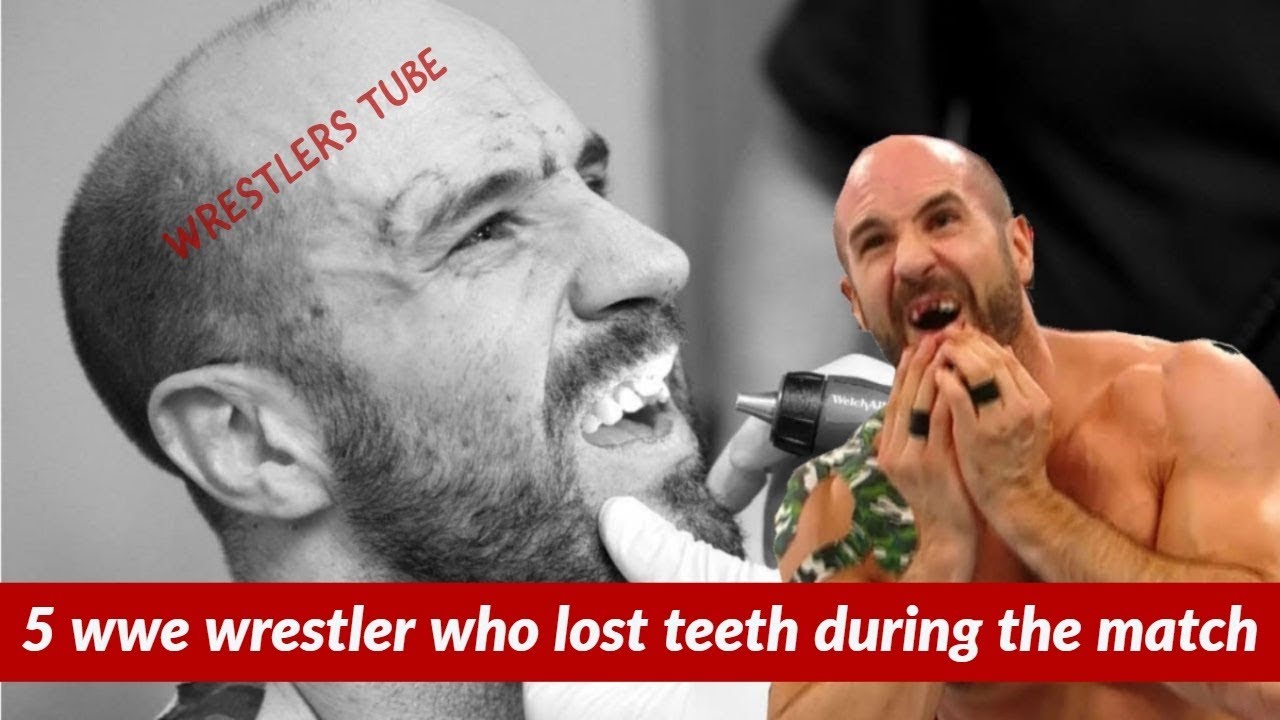 5 WWE Wrestlers Who Lost Teeth During A Match | Roman Reigns | mike ...