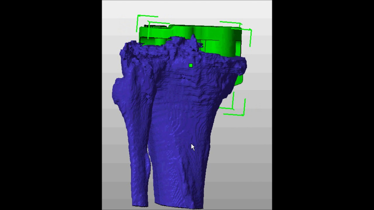 tibia template - YouTube