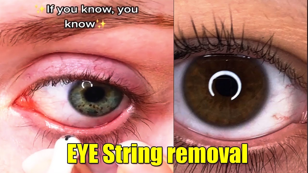EYE string removal HACKS COMPILATION #4 - Beauty Tips For Every Girl ...