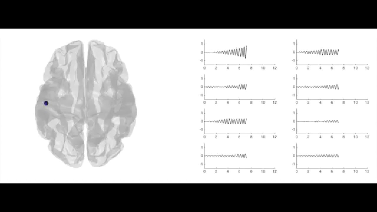 Simulating seizure onset location and progression for temporal lobe ...
