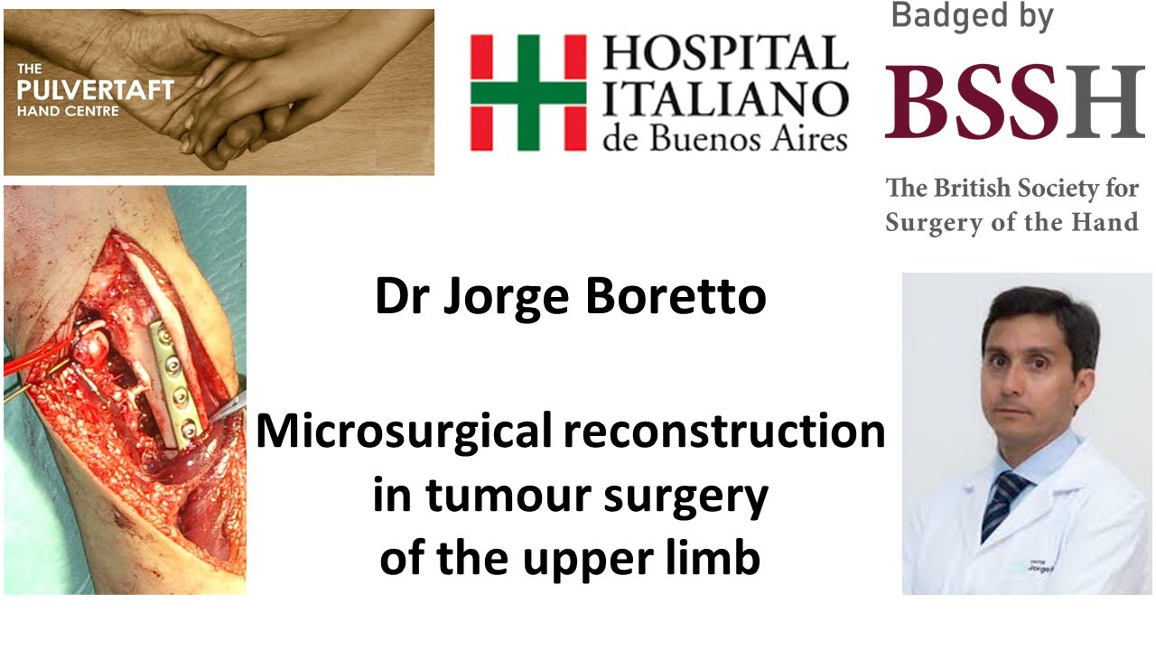 Reconstructive surgery for tumours of the upper limb by Dr Jorge ...