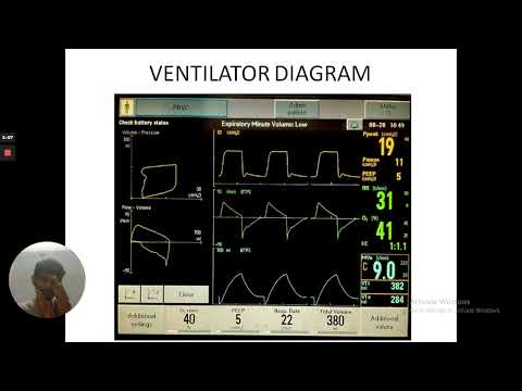 MECHANICAL VENTILATIO PART 4-PRVC MODE OF VENTILATION