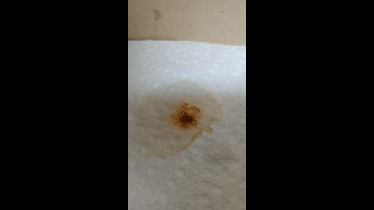 Monarch Butterfly Meconium - YouTube