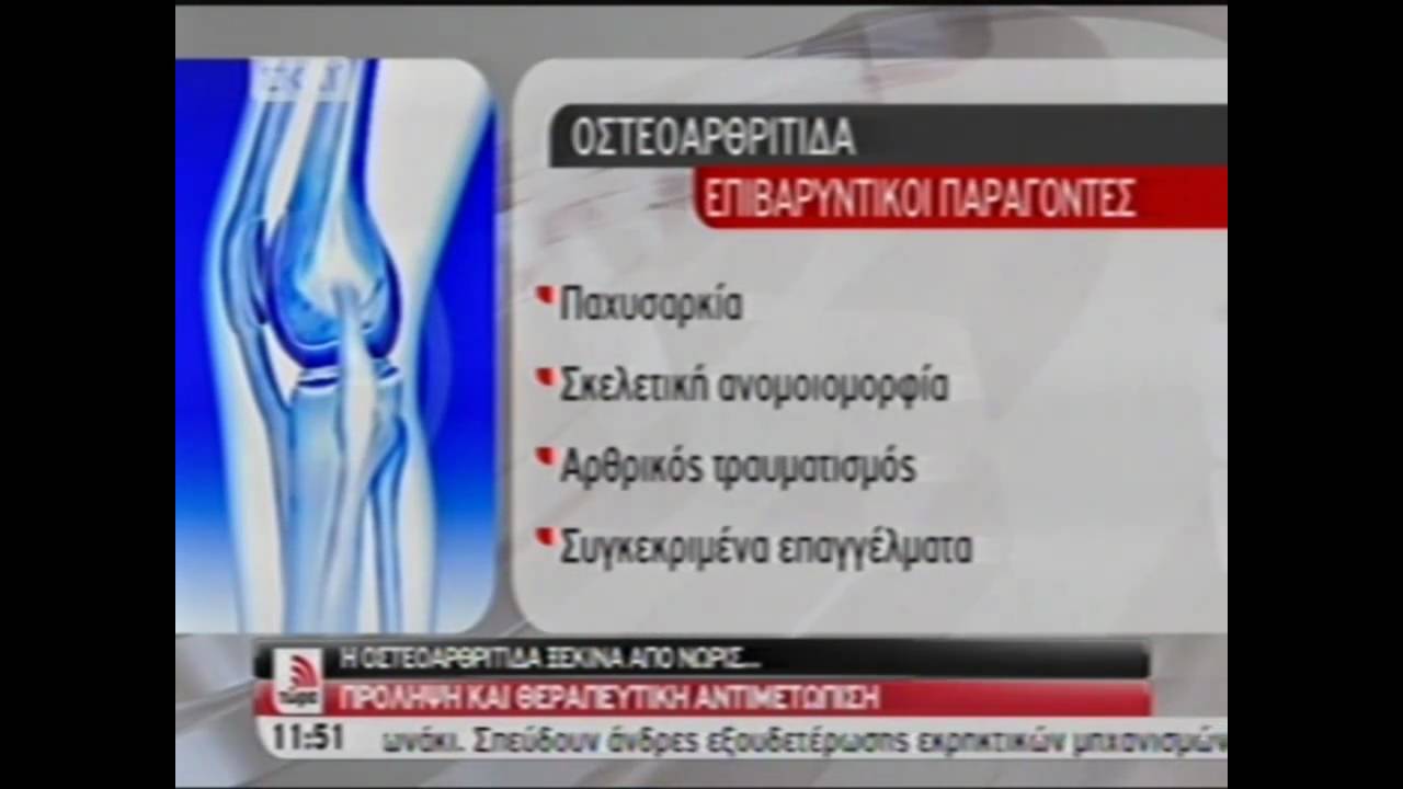 ΟΣΤΕΟΑΡΘΡΙΤΙΔΑ ΕΚΦΥΛΙΣΤΙΚΗ ΑΡΘΡΙΤΙΔΑ Youtube