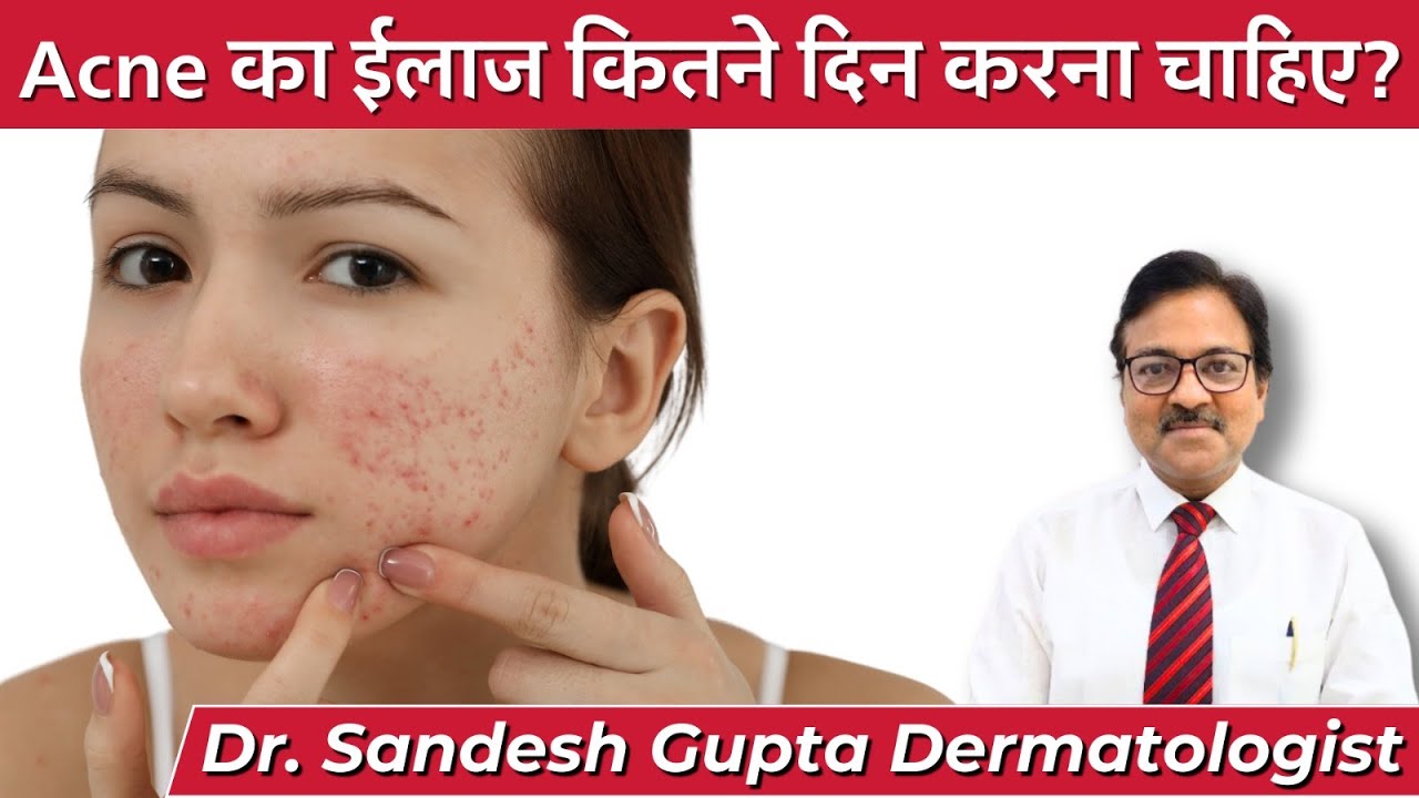Acne/Pimples कैसे ठीक करें| Acne Treatment & Medicines | How to Get Rid ...