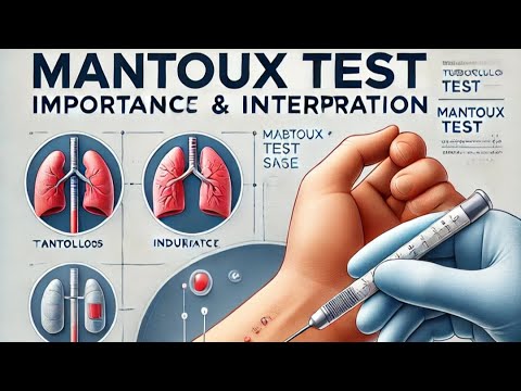 Mantoux test/procedures/what should know about TB skin test/Mantoux ...