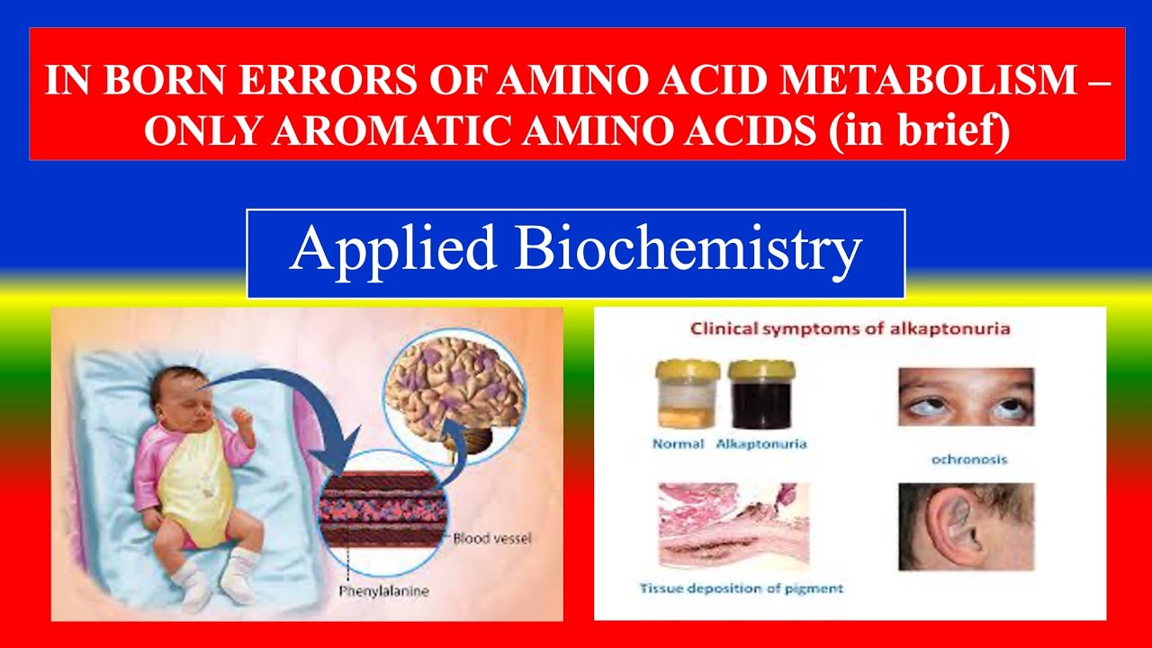 IN BORN ERRORS OF METABOLISM – AROMATIC AMINO ACIDS -- Applied ...