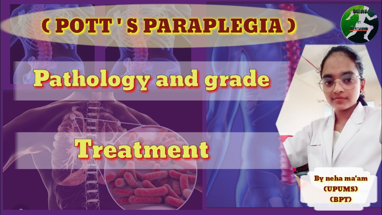 POTT'S PARAPLEGIA || Tb spine with nerurological involvement|| types ...