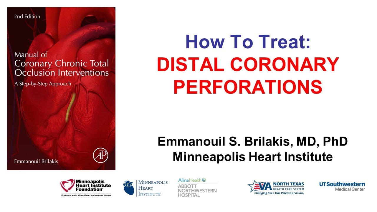 How to treat distal coronary perforations - YouTube