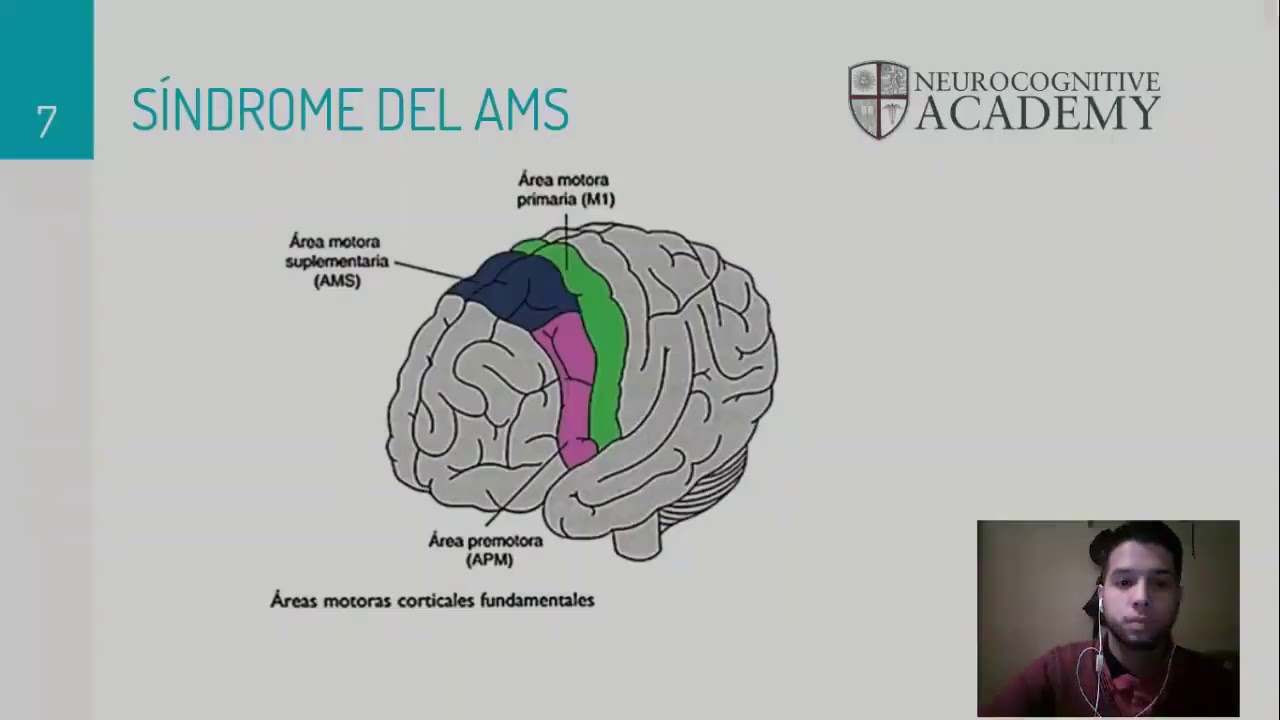 ¿Shock espinal e hipotonía tras el ictus? - YouTube