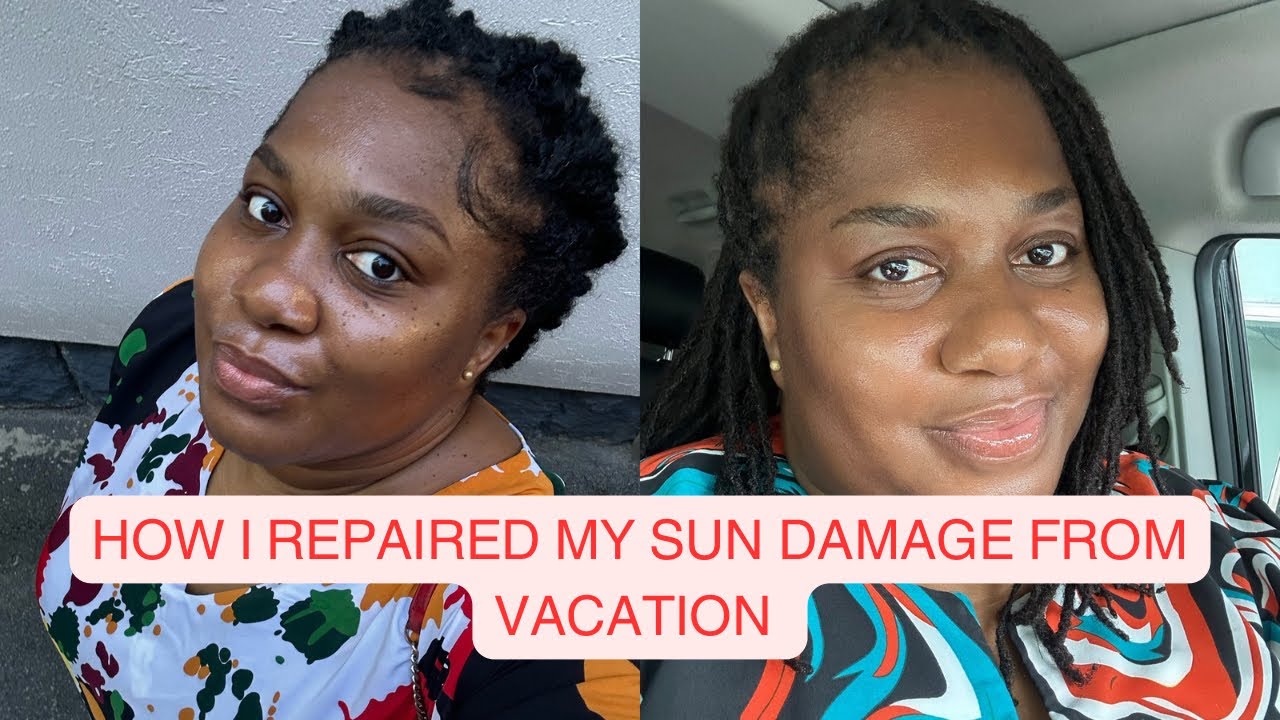 HOW I AM REPAIRING SUN DAMAGE ON MY FACE - YouTube