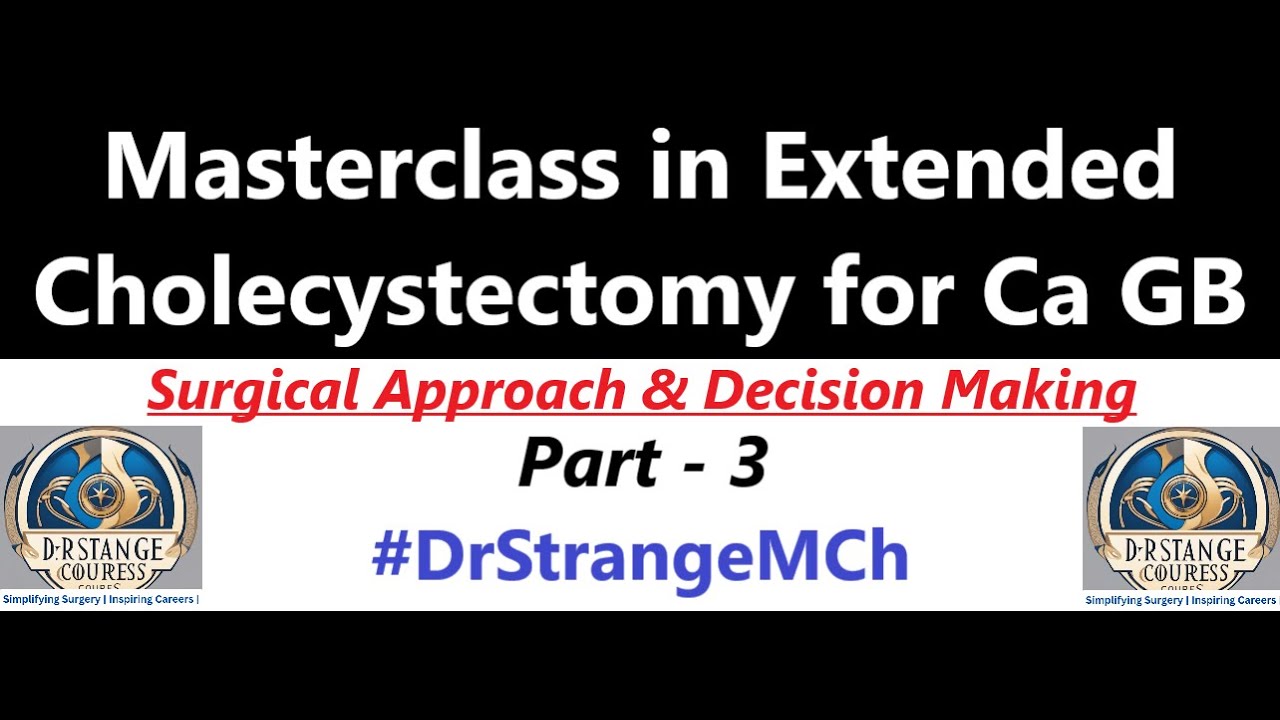 GB Cancer Live Surgery- Part 3: Non-Anatomical Liver Wedge Resection ...