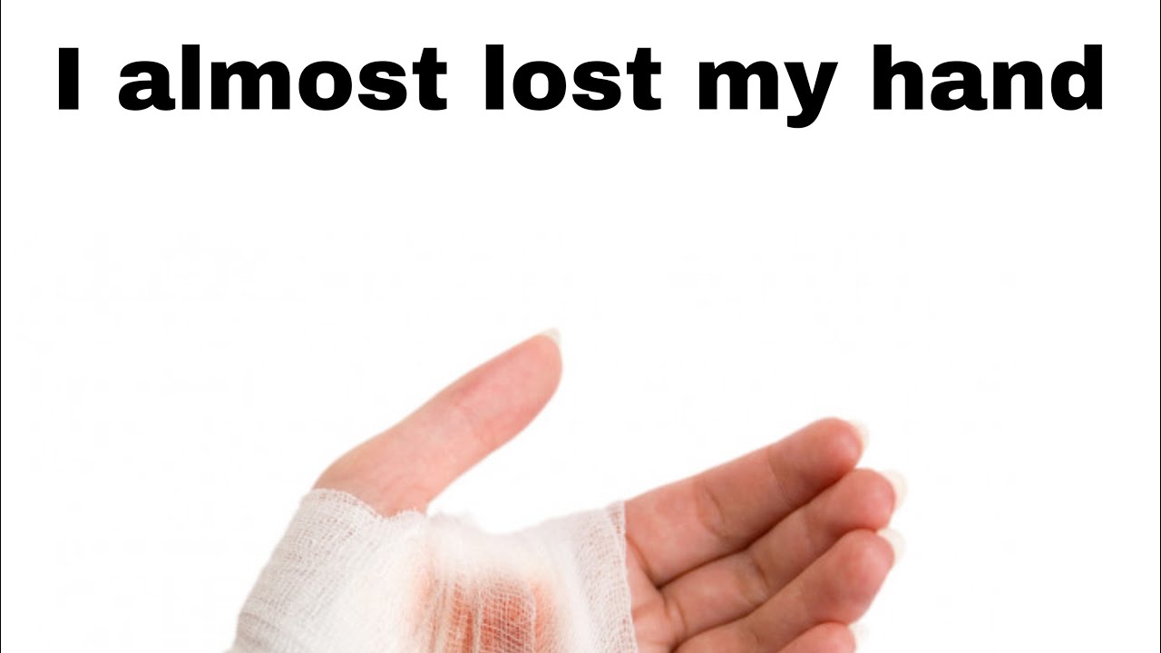 I almost lost my hand - YouTube