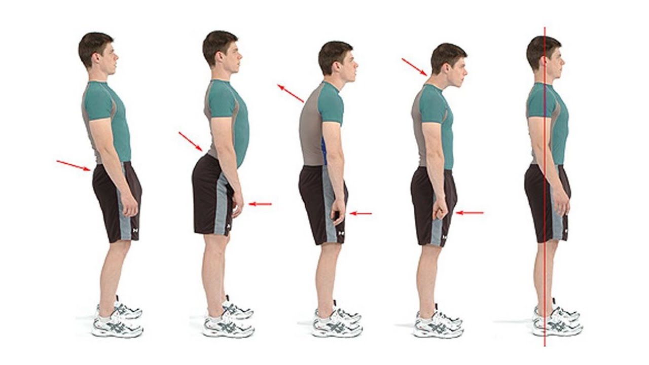 La importancia de la evaluación postural - YouTube