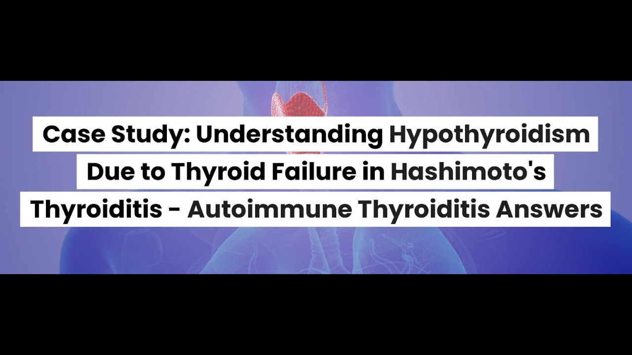 Hypothyroidism Due to Thyroid Failure in Hashimoto's Thyroiditis - Autoimmune Thyroiditis ...