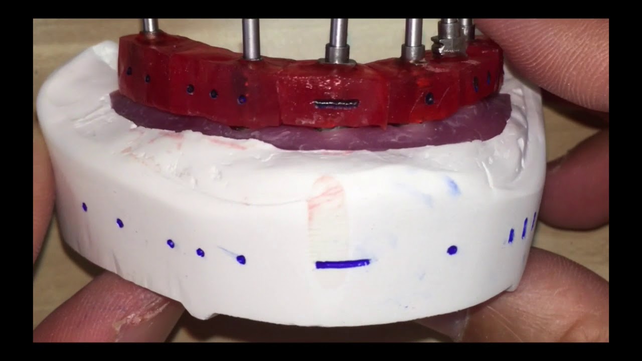 Easy Acrylic Verification Jig - YouTube