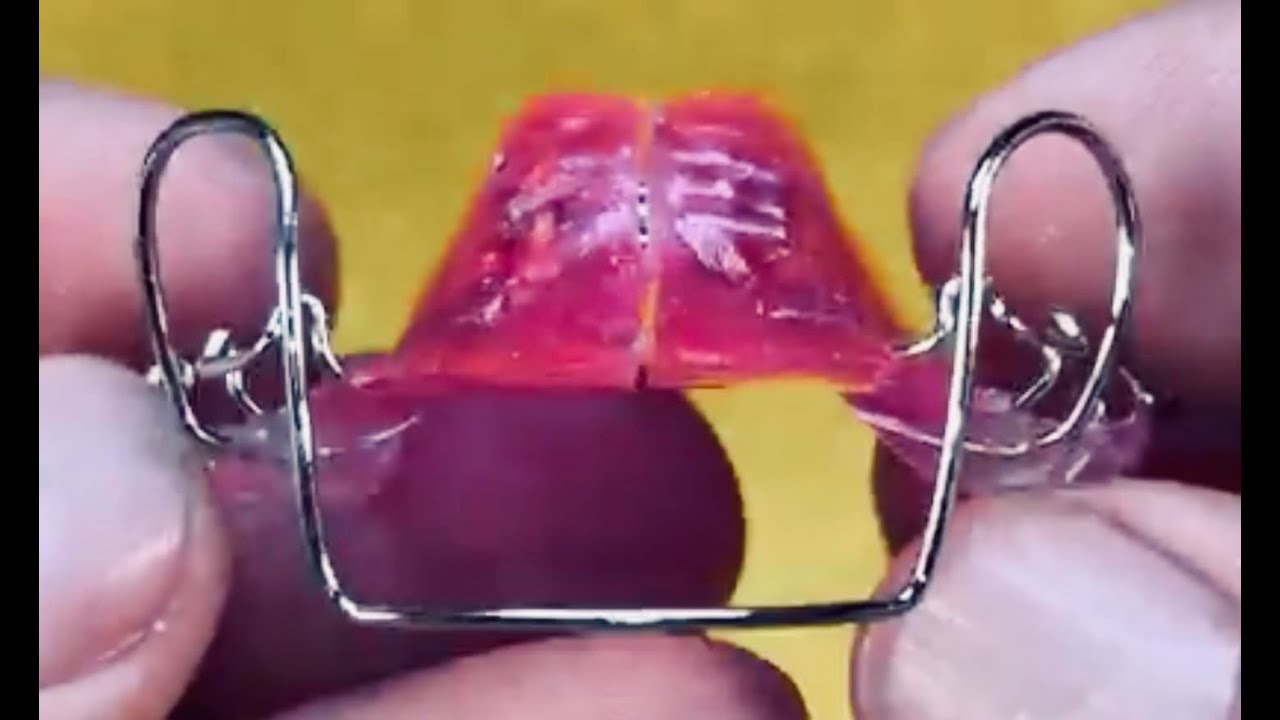 APARATO PROGENIE - YouTube