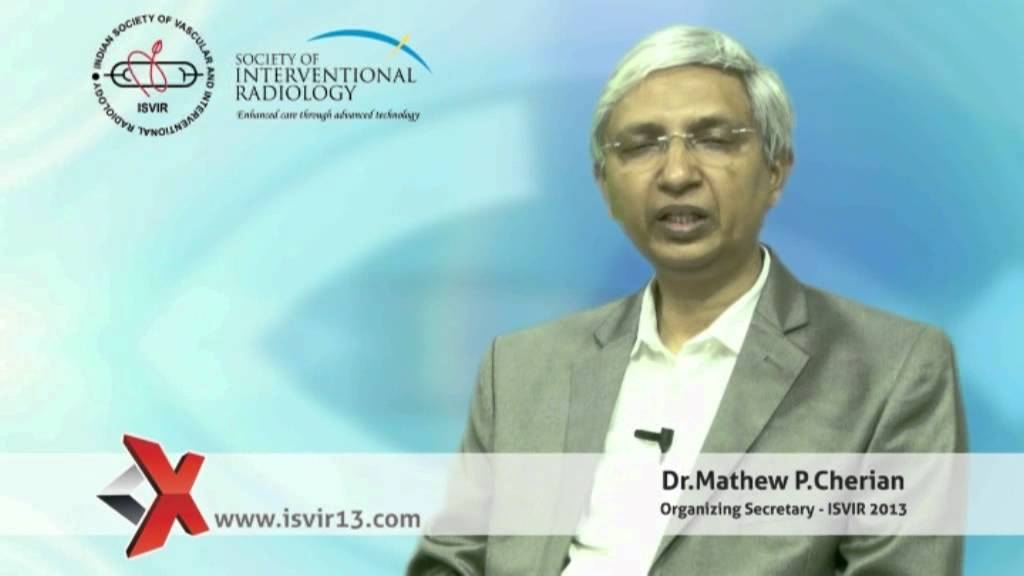 Dr. Rene Chapot talks about Percutaneous embolectomy in stroke - YouTube
