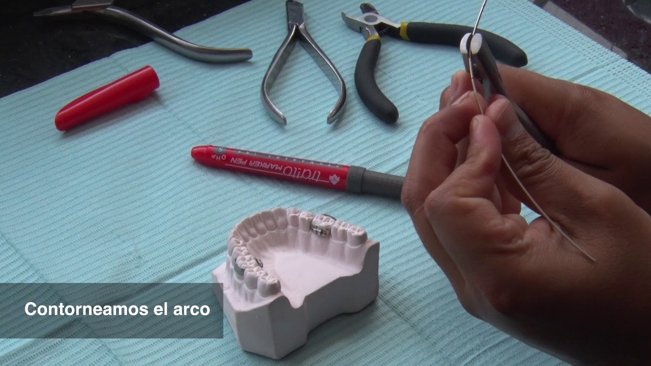 barra palatina arco lingual - YouTube