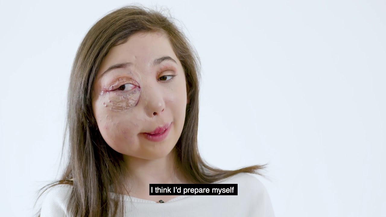 Face Equality 2018 - Young Champions with Visible Differences - # ...