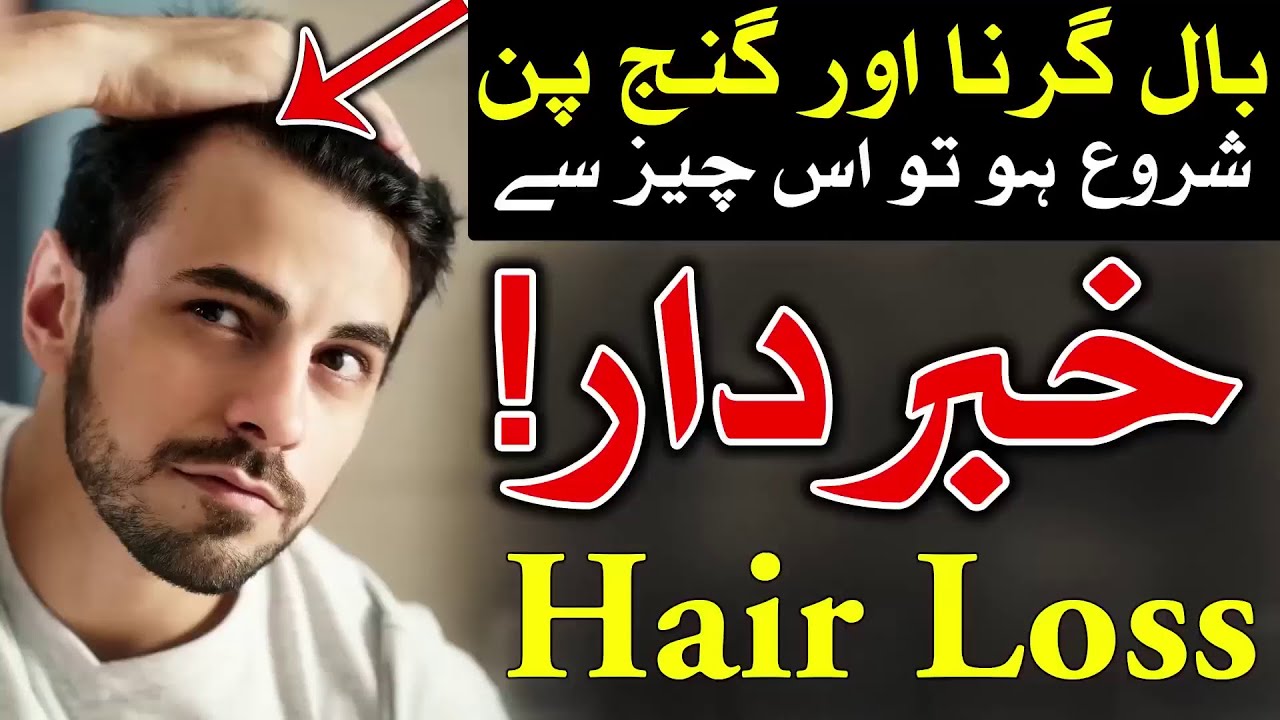 Hair Gerna Start Hon to Khbardar | Baal Ka Gerna | Mehrban Ali ...