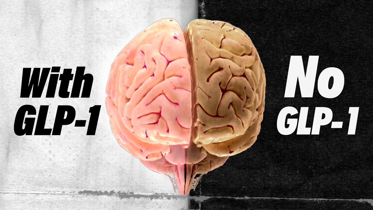 How GLP-1 Agonists May Protect Your Brain - YouTube