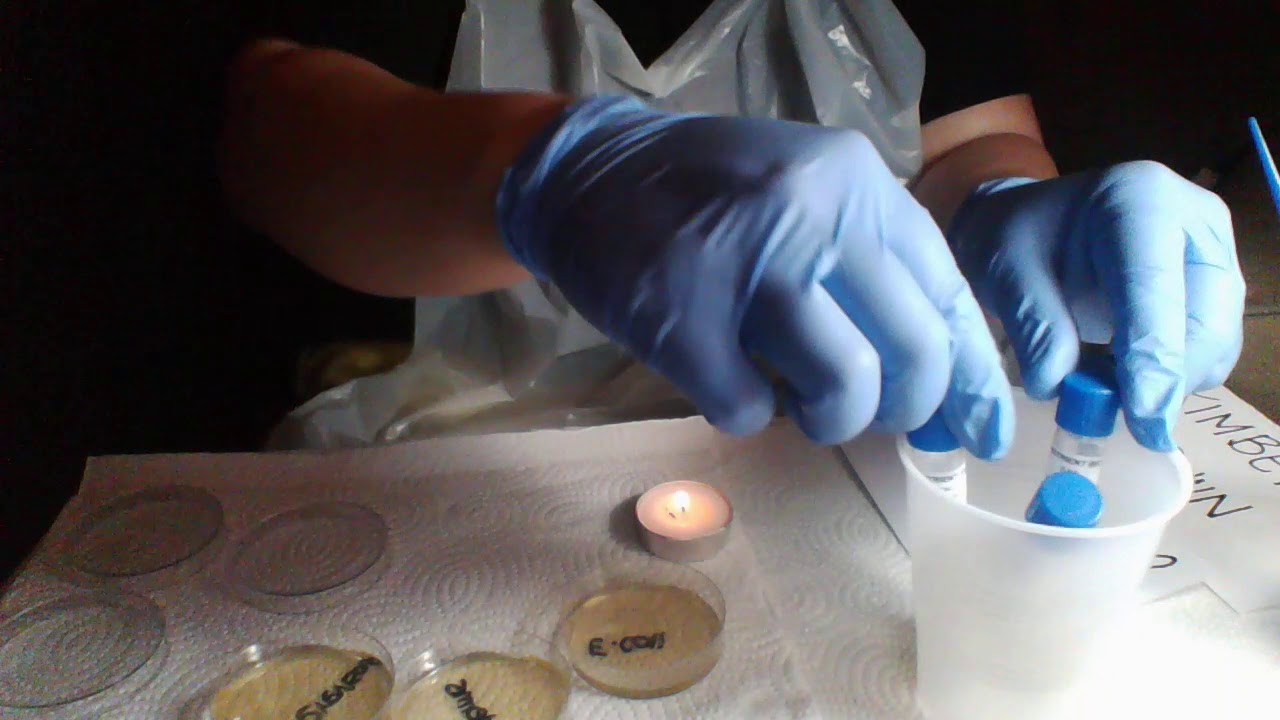 Results-Exercise 2 Isolating individual colonies. - YouTube