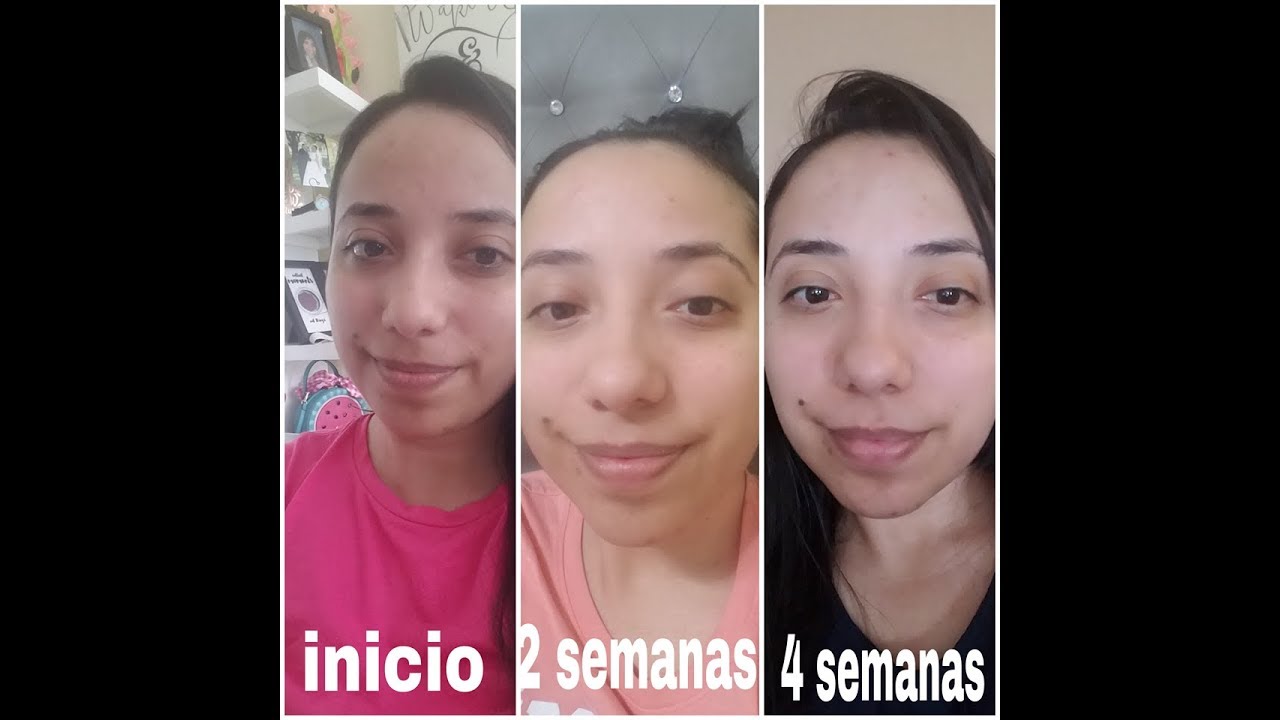 PONDS Clarant B3 Review, Funciona? - YouTube